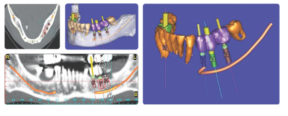 쉽게 따라올 수 없는 KaVo만의 품질