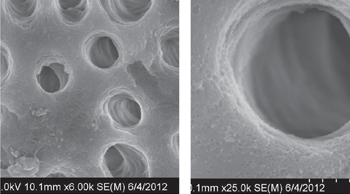 ‘EndoPrep Gel’ 효과입증